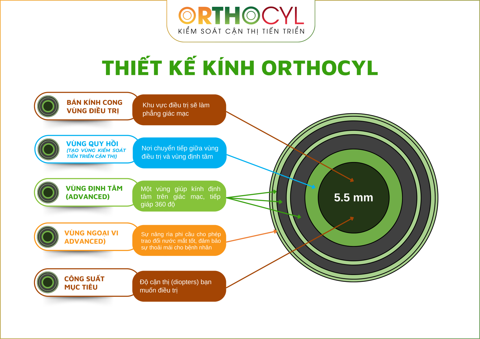 ORTHO-K LÀ GÌ? - ORTHO-K | Kính Áp Tròng Đeo Ban Đêm